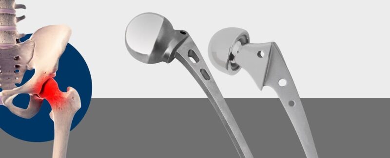 What is the importance of hip prosthesis in the orthopedic industry ...