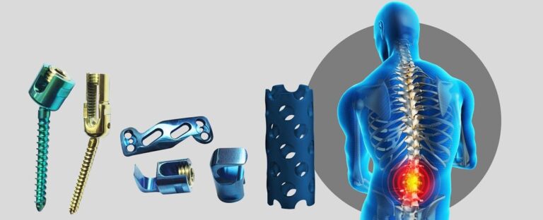 What are Spine Implants and their Types & Benefits? - HEMC Ortho