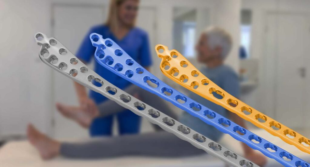 Locking Medial Distal Tibial Plate Archives - HEMC Ortho