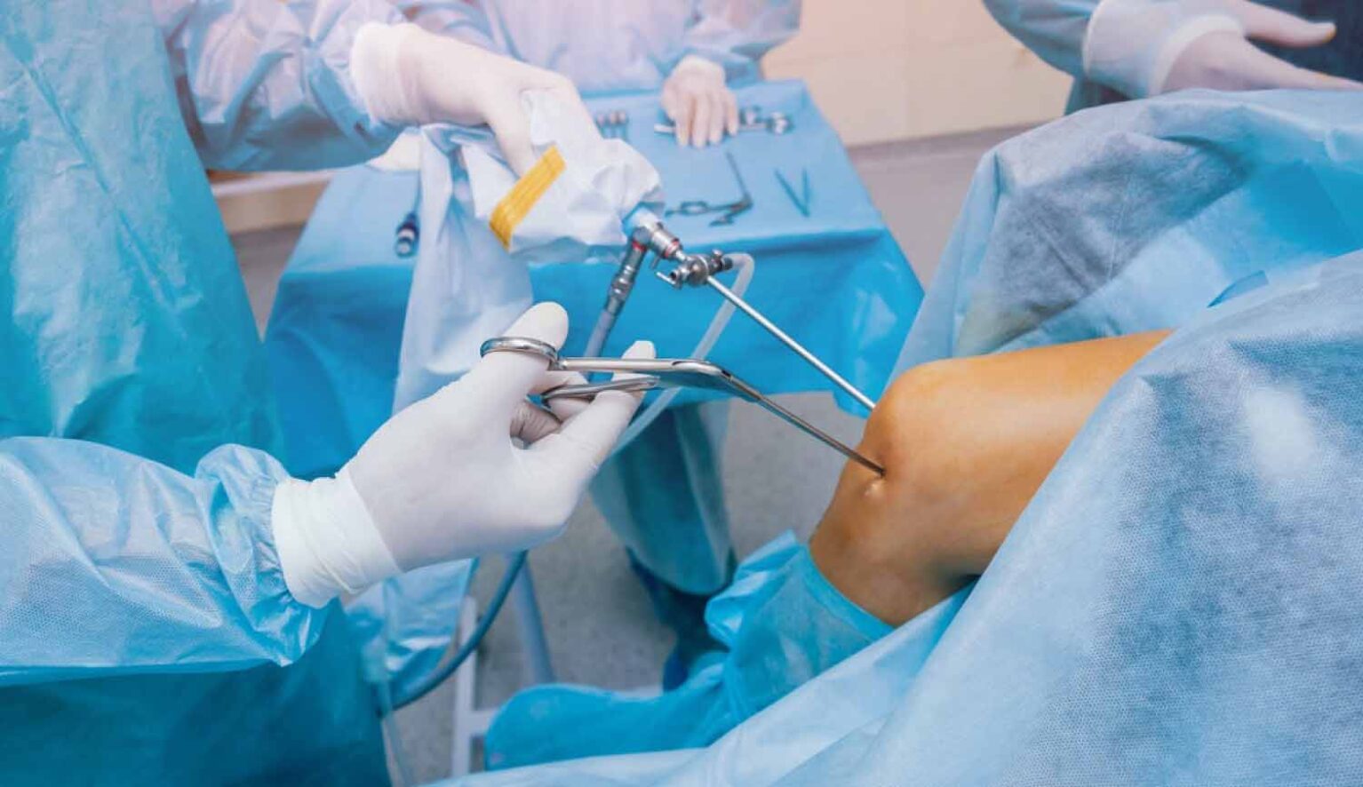 An Overview of Arthroscopy: What it is and how it works - HEMC Ortho